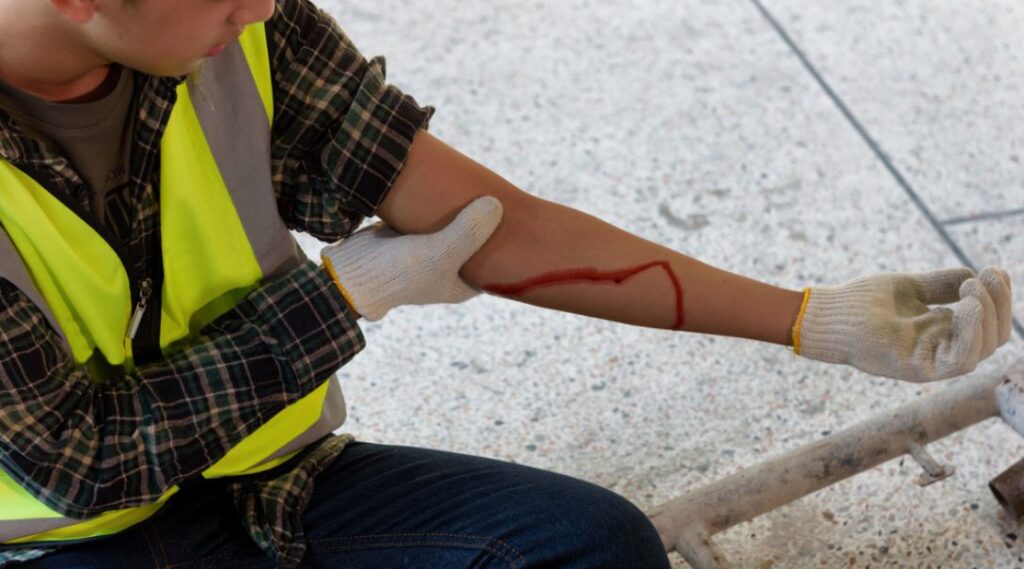 What Are Two Ways To Tell If Bleeding Is Life-Threatening: A Guide | AOTC